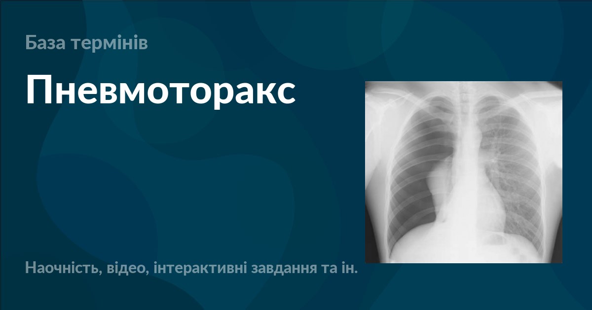 Пневмоторакс – УМІТИ